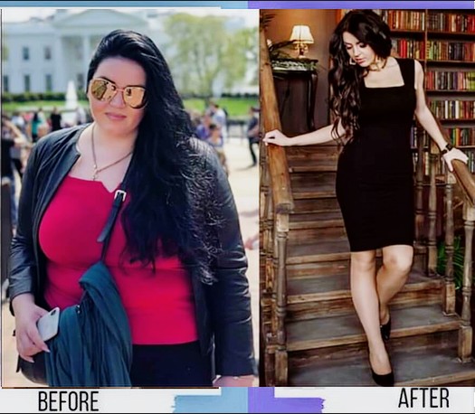 Affordable Weight Loss Clinic Miami, Weight Loss Doctor Miami - Obesity Treatment and Medical ...